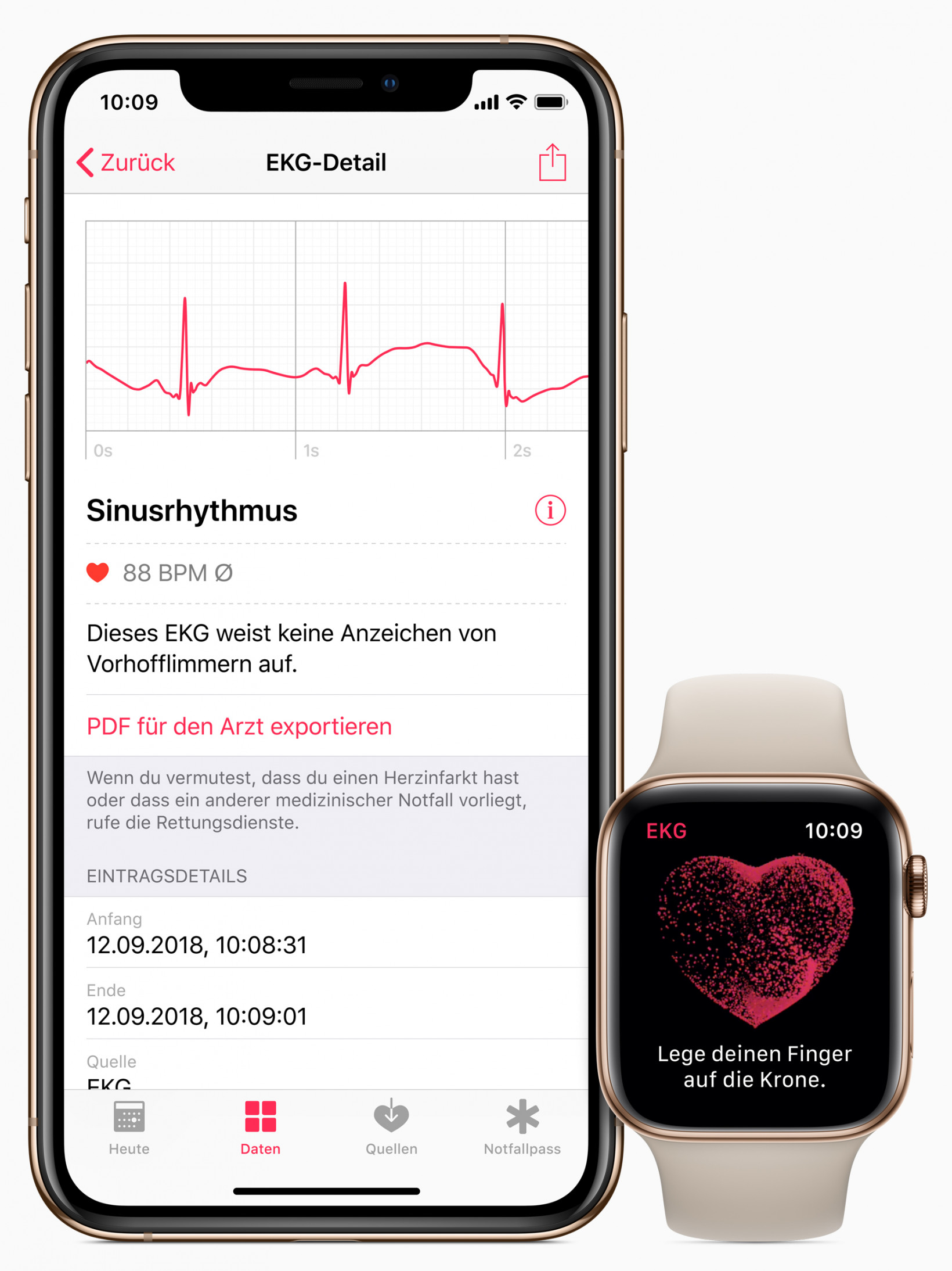 Why I’m elated Apple Watch’s ECG feature is now available in Europe