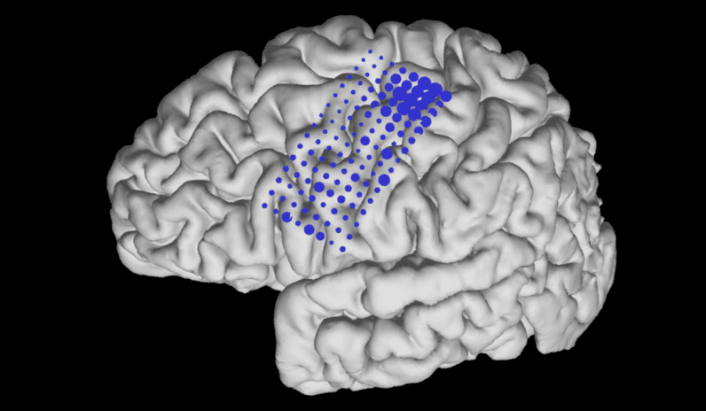 Scientists demonstrate first ‘plug and play’ brain prosthesis in a ...